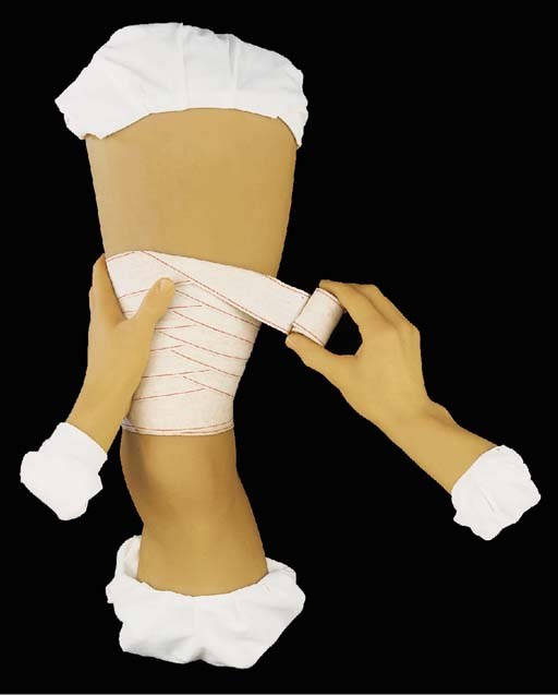 A demonstration of the correct application of a bandage on the leg ...