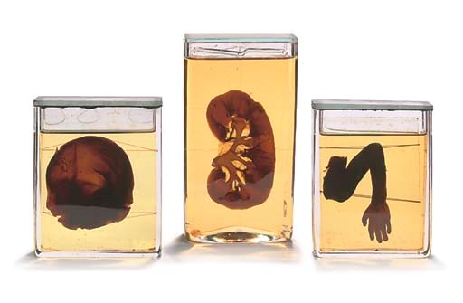 Three fluid-preserved specimens of human body parts, | Christie's