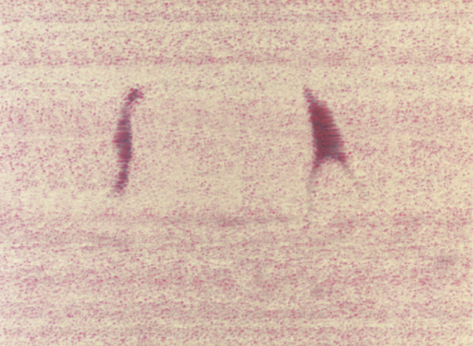 MICHAL ROVNER (B. 1957)